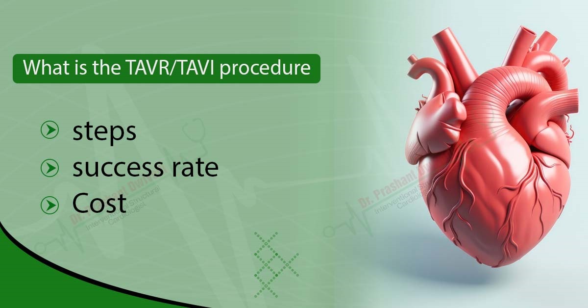 What is the TAVR/TAVI Procedure: Steps, Success Rate and Cost